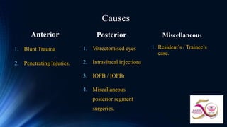 Occult Posterior capsular rent | PPT