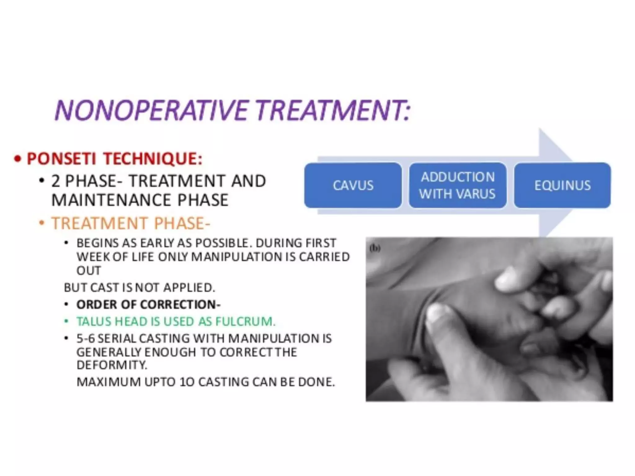 CTEV Imaging, Classification, Pirani scoring system, conservative ...