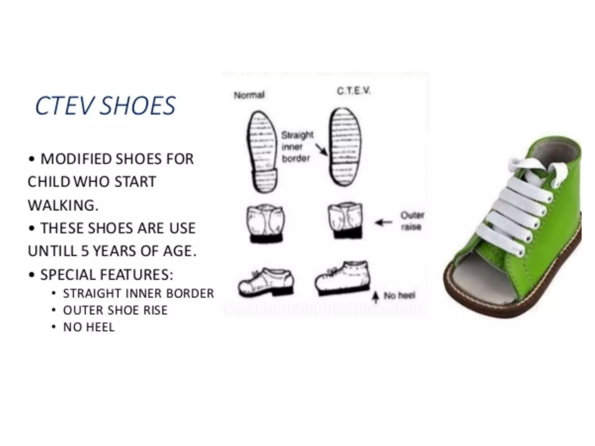 CTEV Imaging, Classification, Pirani scoring system, conservative ...