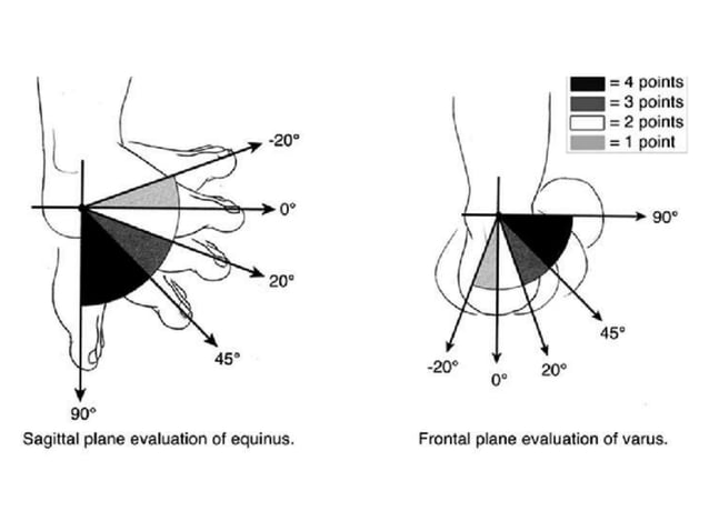 CTEV Imaging, Classification, Pirani scoring system, conservative ...