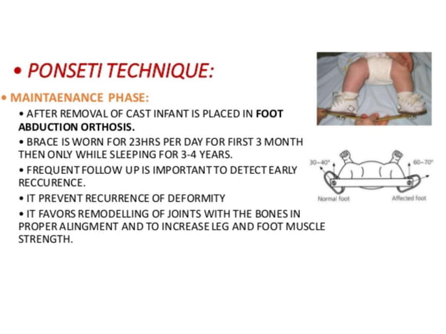 CTEV Imaging, Classification, Pirani scoring system, conservative ...