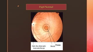 KKD SEGMENT POSTERIOR, ISIHARA.pptx