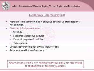 HIV-AIDS.ppt
