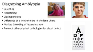 Ayurveda treatment and Eye exercises in Amblyopia | PPTX