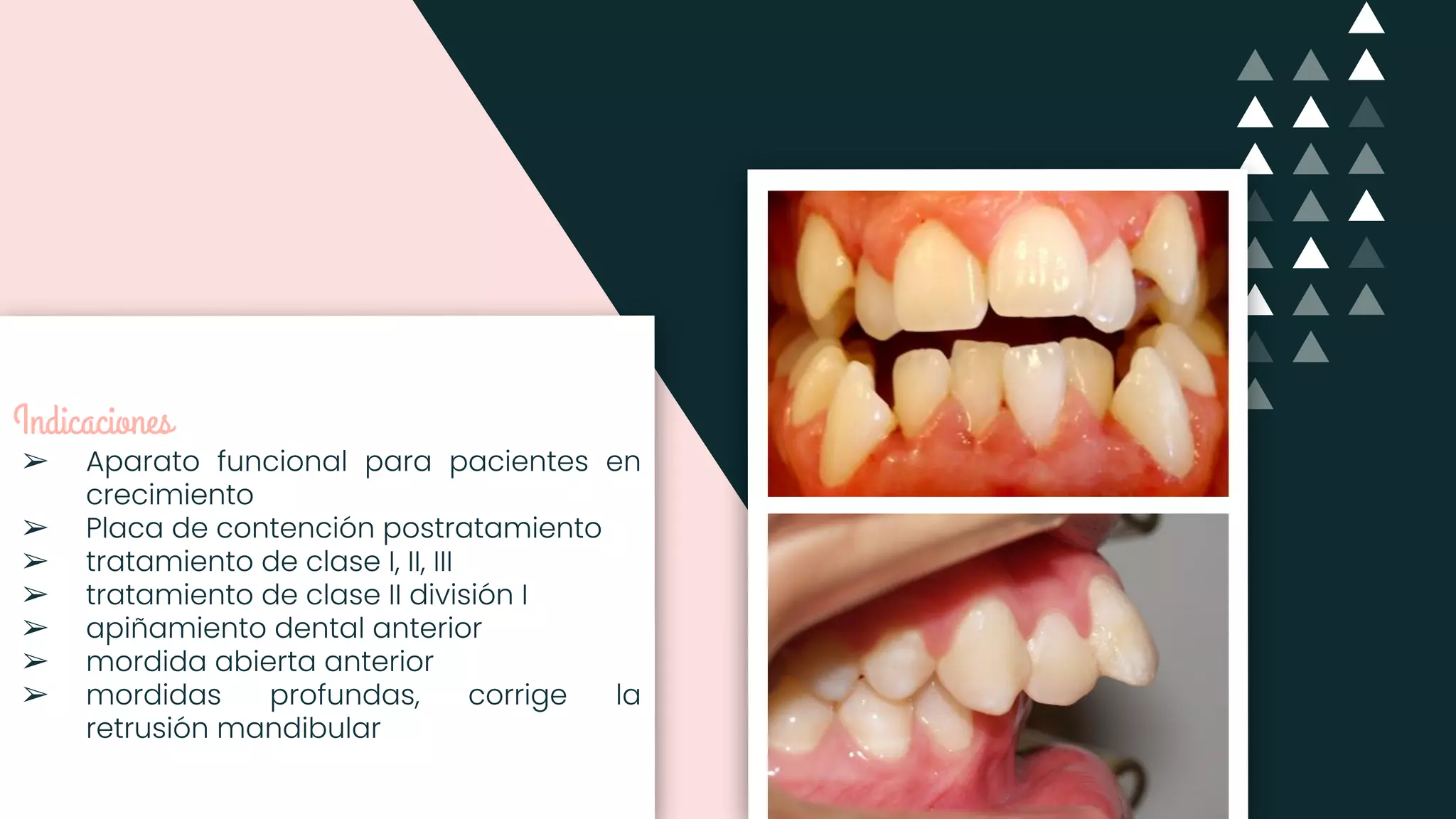 Klammt ortodoncia | PDF