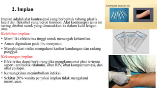 KLASIFIKASI_ALAT_KONTRASEPSINNFFFF[1].pptx