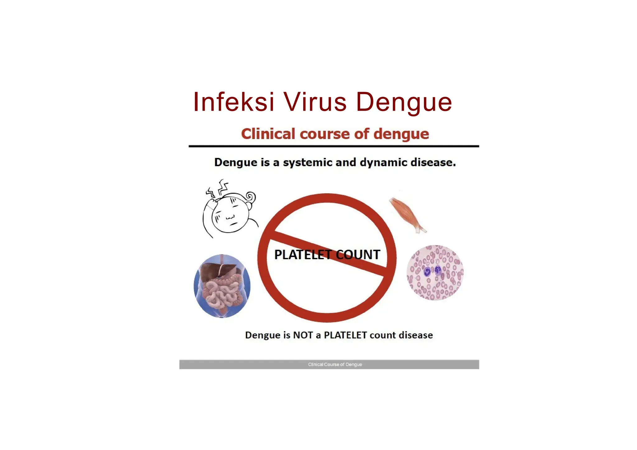Klasifikasi Dan Tatalaksana Dengue Anak Sesuai PNPK.pptx