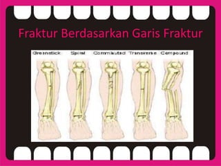 Klasifikasi frajtur berdasarkan garis fraktur | PPTX