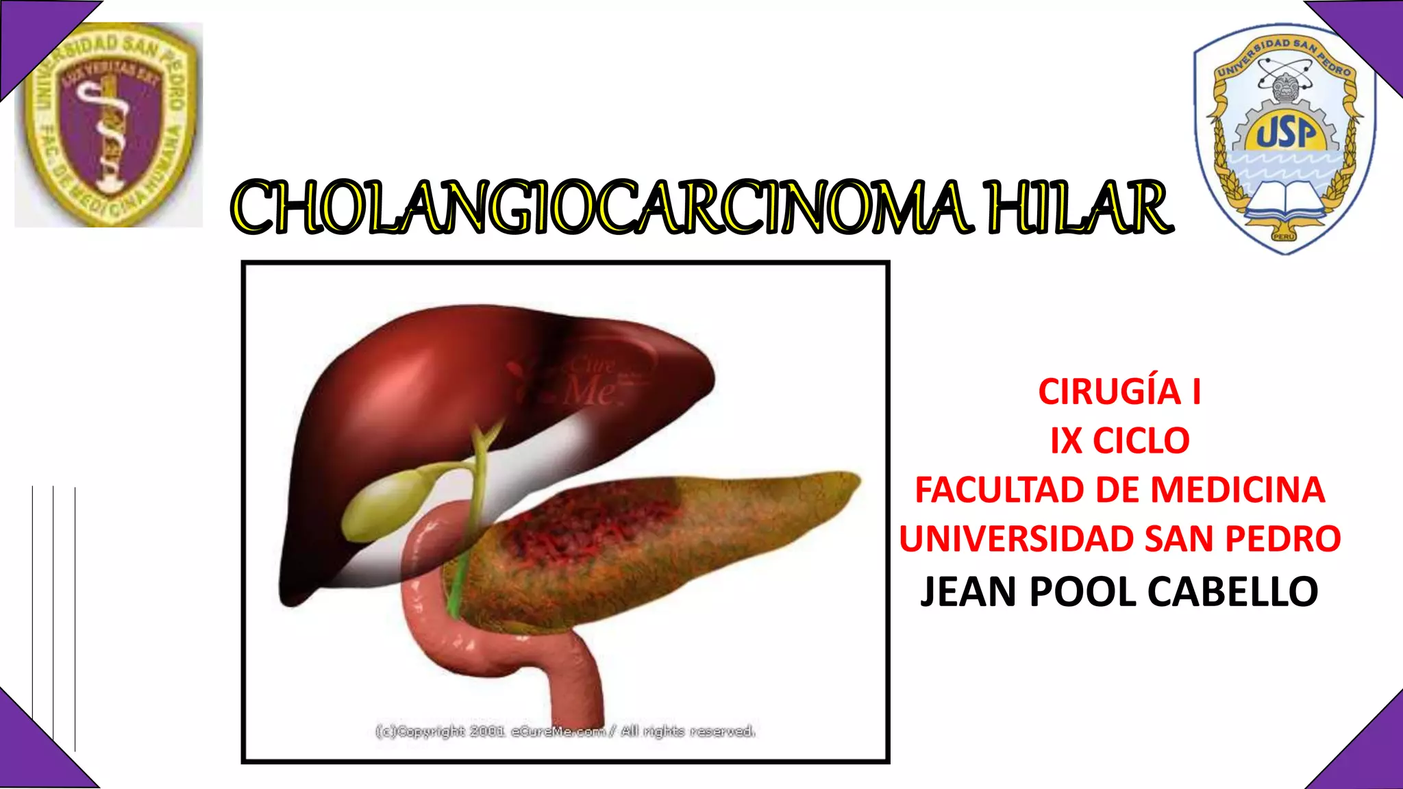 Tumor de Klatskin - Colangiocarcinoma Hiliar | PPTX