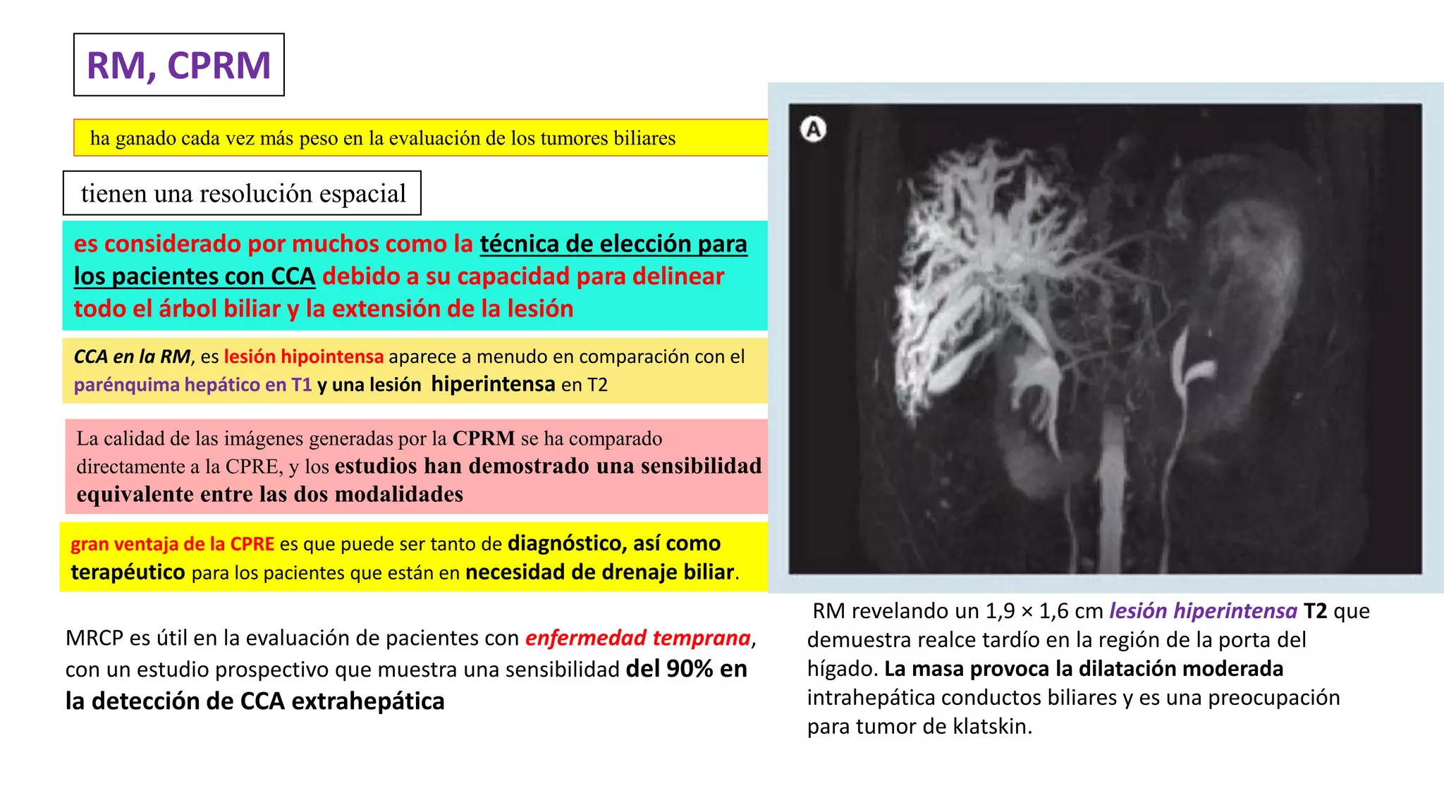 Tumor de Klatskin - Colangiocarcinoma Hiliar | PPT