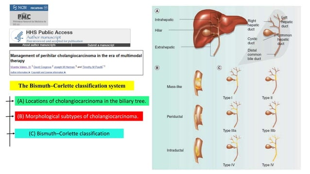 Tumor de Klatskin - Colangiocarcinoma Hiliar | PPTX