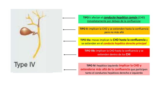 Tumor de Klatskin - Colangiocarcinoma Hiliar | PPTX
