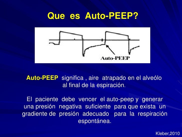 Indices en Ventilacion Mecanica
