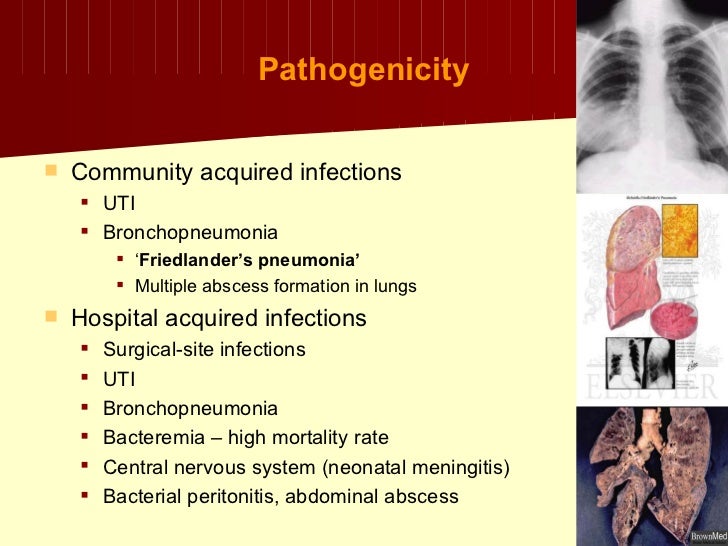 Klebsiella+proteus+uti