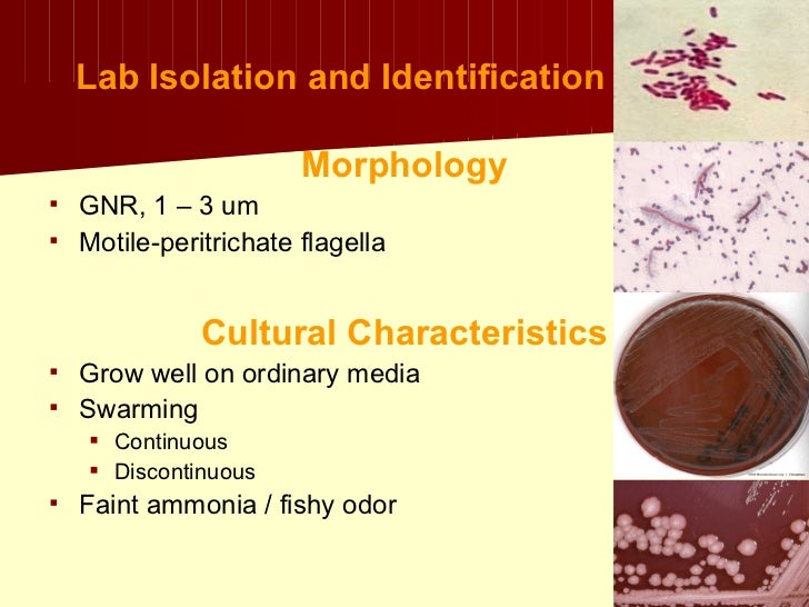 Morphology Culture Characteristics Of Proteus Vulgaris