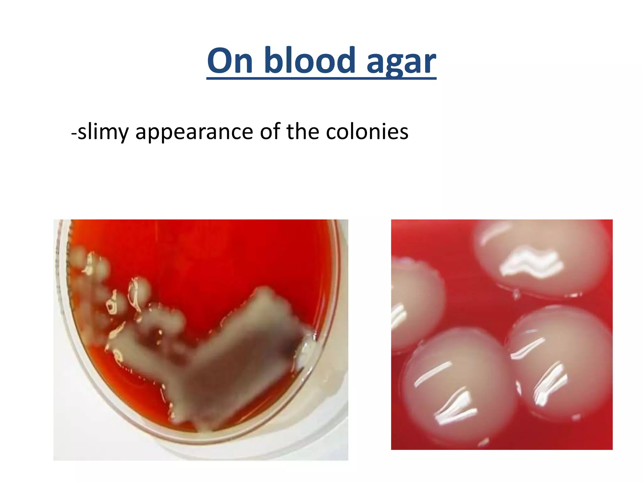 Klebsiella spp | PPTX
