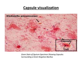 Klebsiella spp | PPTX