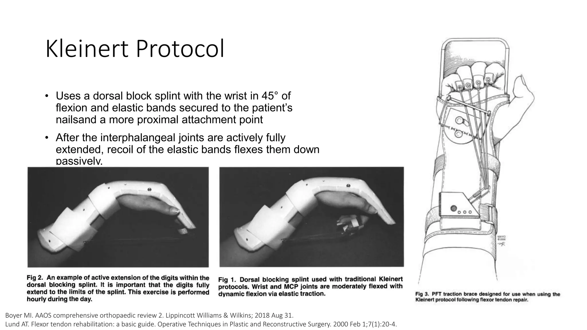 Kleinert and Duran Protocols.pptx