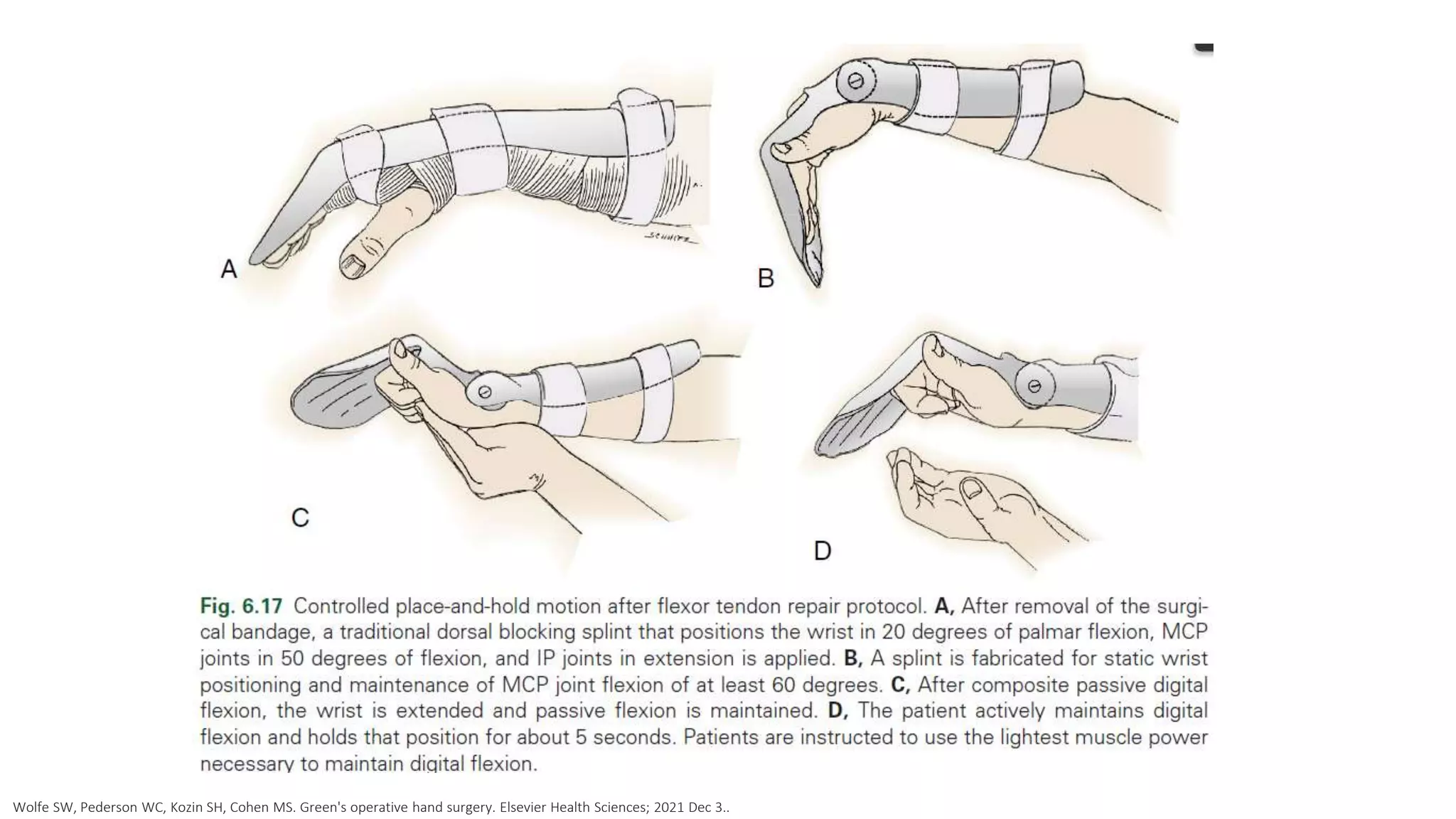 Kleinert and Duran Protocols.pptx