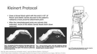 Kleinert and Duran Protocols.pptx