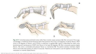 Kleinert and Duran Protocols.pptx