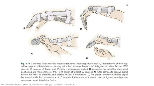 Kleinert and Duran Protocols.pptx