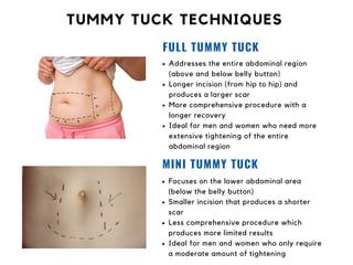 Tummy Tuck: Discover the Beautiful Results that Await You | PPT