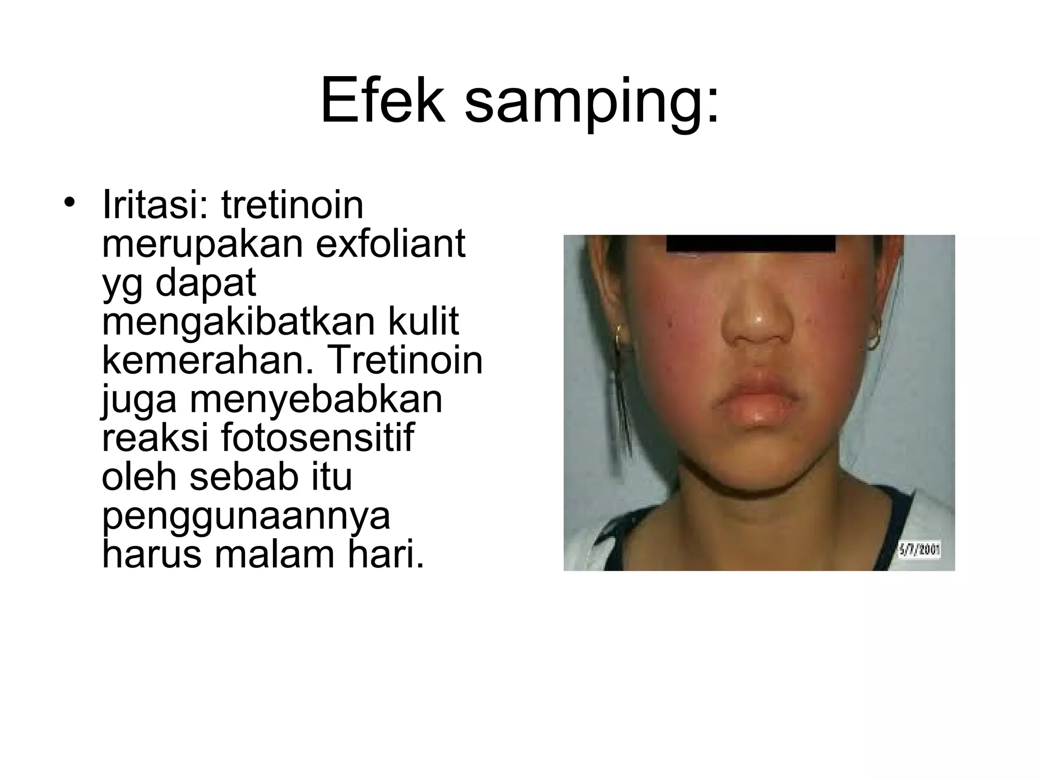 Kligman formula dalam praktek skin care | PPT