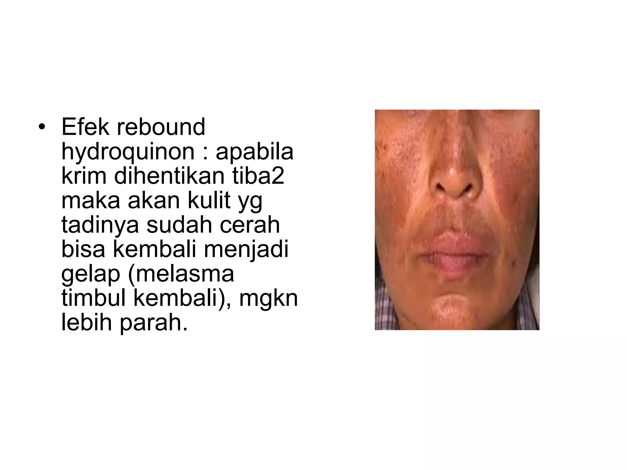 Kligman formula dalam praktek skin care | PPT