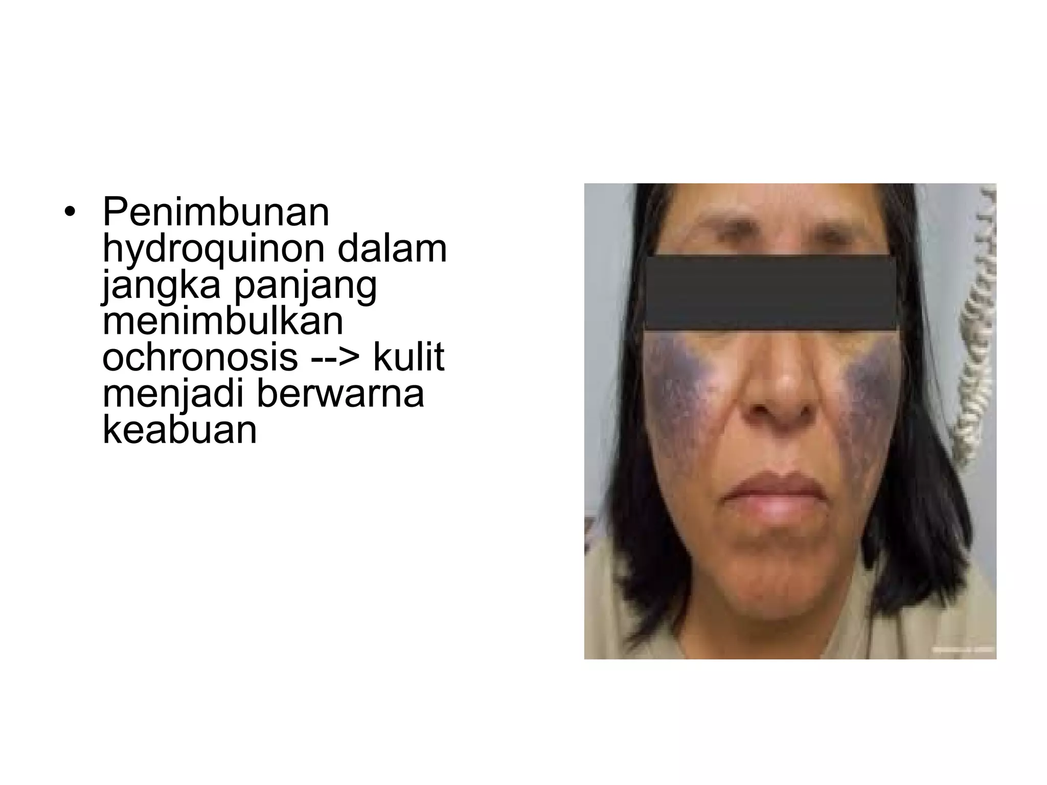 Kligman formula dalam praktek skin care | PPT