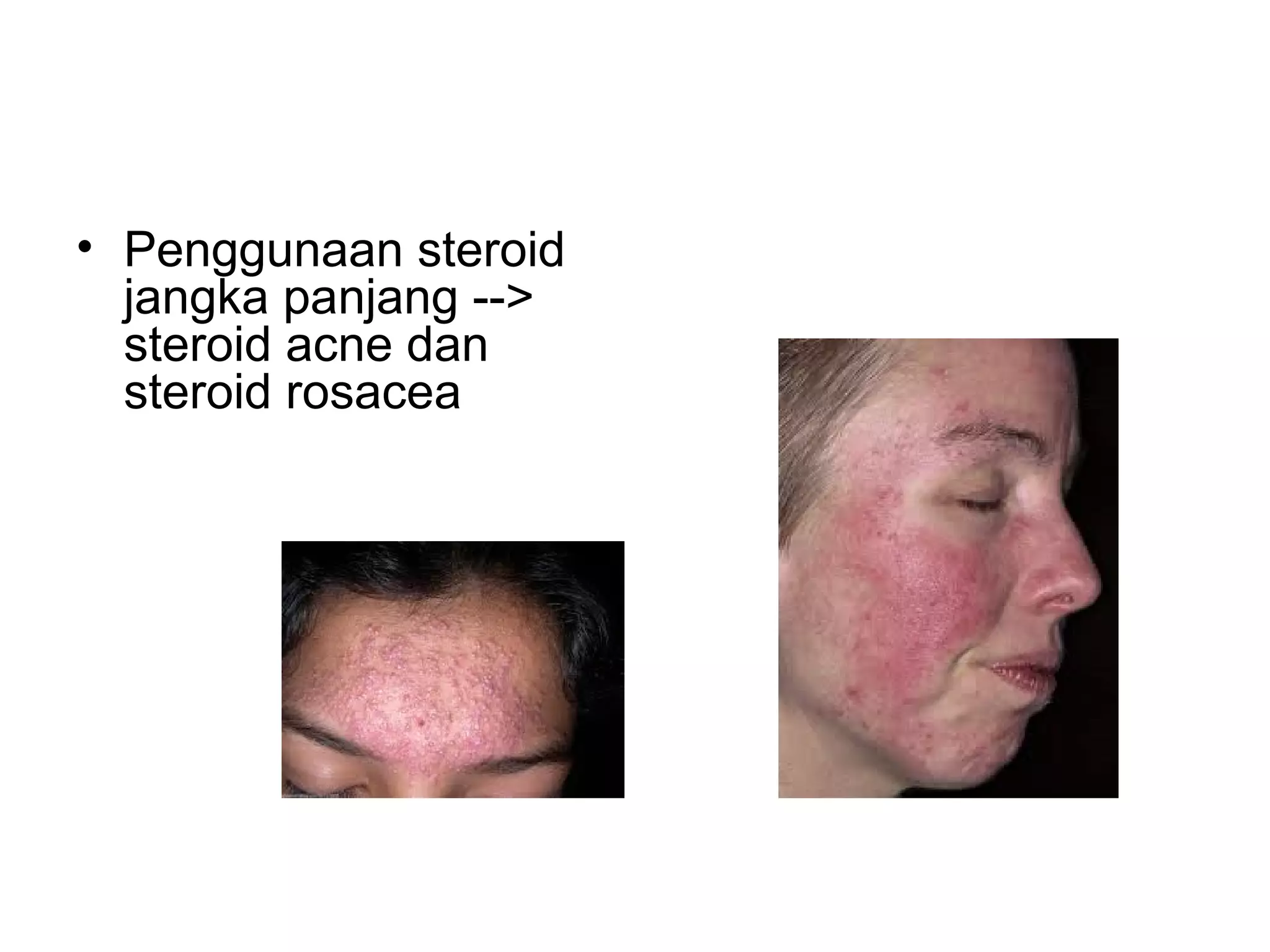 Kligman formula dalam praktek skin care | PPT
