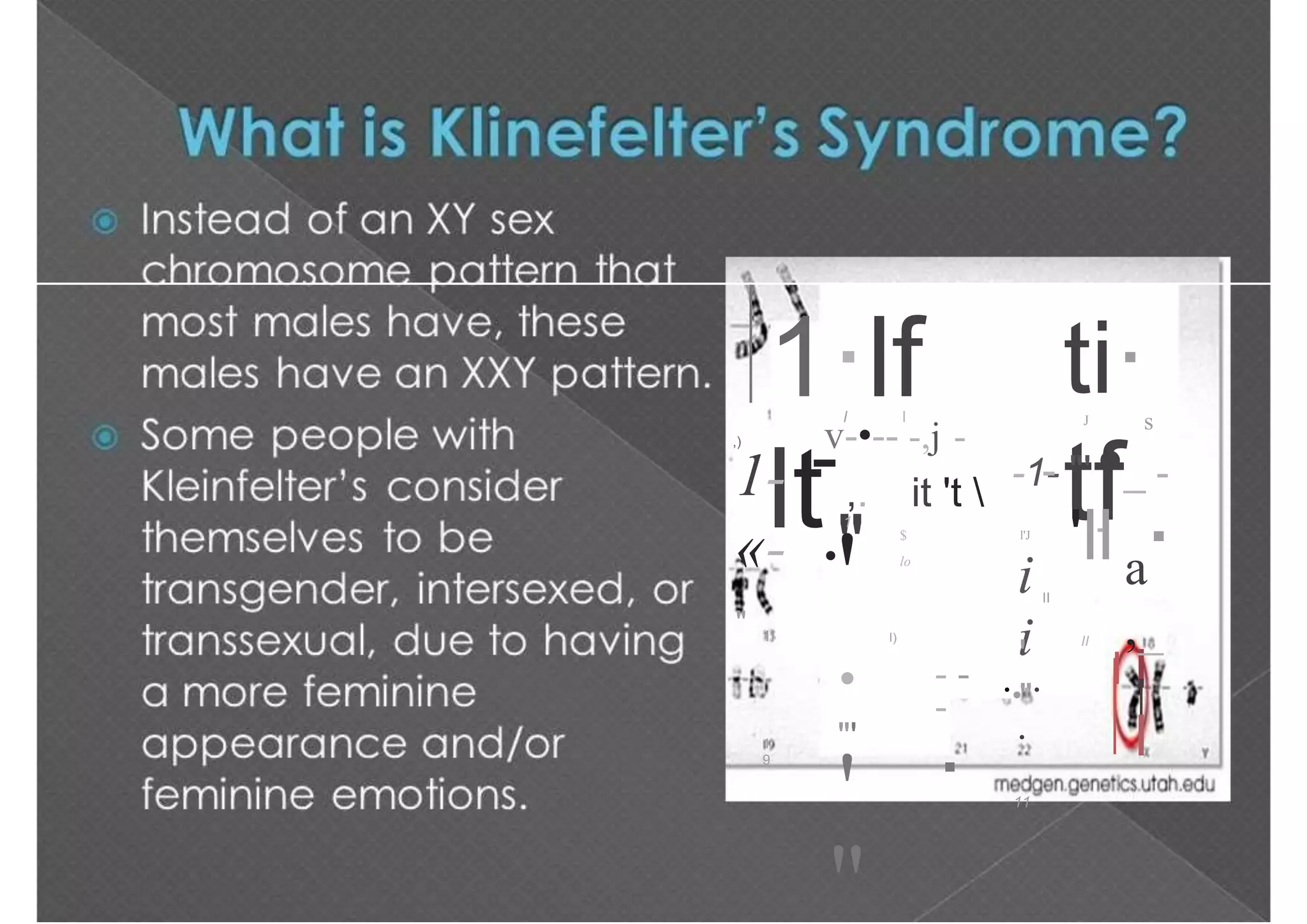 Klinefelter’s+Syndrome (1) (13 files merged).ppt | Infertility ...