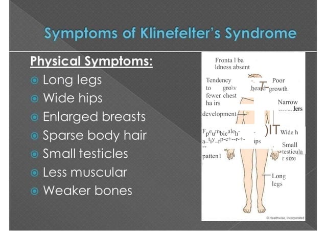 Klinefelter’s+Syndrome (1) (13 files merged).ppt | Infertility ...