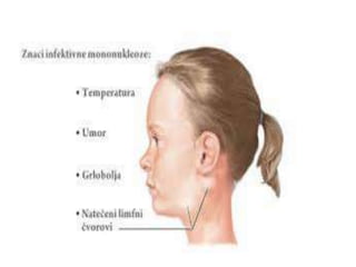Klinicka slika,dijagnoza i vrste bolesti limfocitne loze | PPT