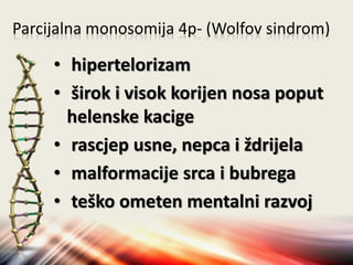 Klinički sindromi autosomnih kromosomskih anomalija. | PPSX