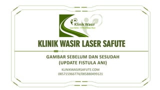 KLINIK WASIR SAFUTE | PDF