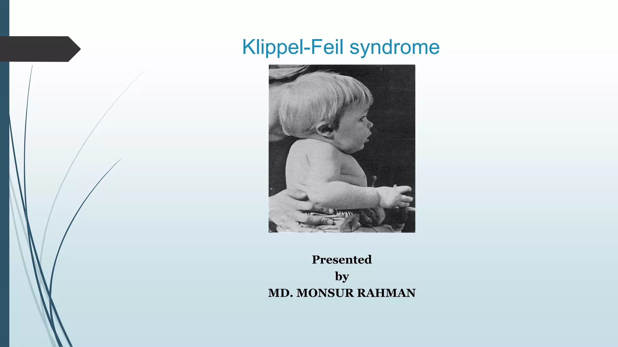Klippel feil syndrome | PPTX | Death, Injury, or Military Conflict ...