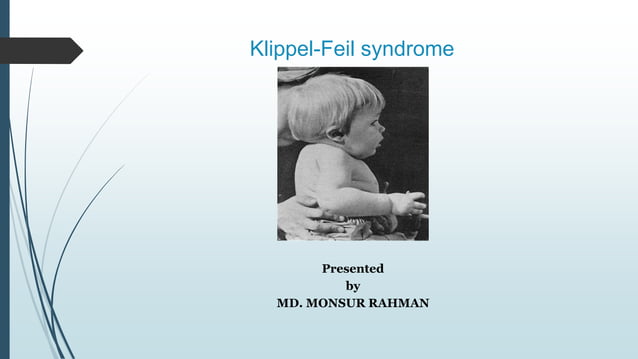 Klippel feil syndrome | PPTX | Death, Injury, or Military Conflict | Sensitive Topics