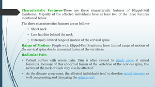 Klippel feil syndrome | PPTX