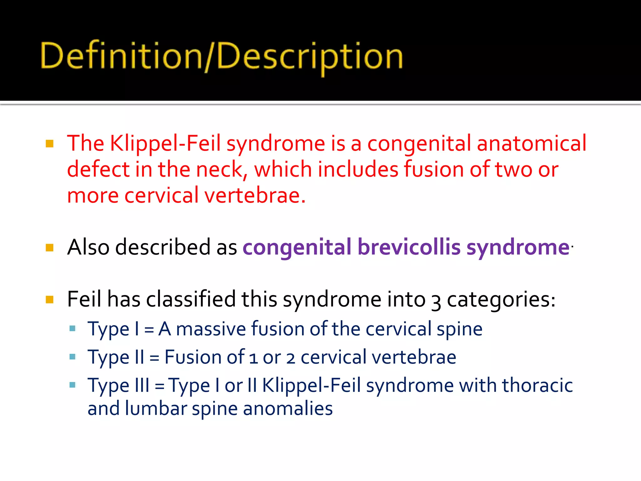 Klippel-Feil Syndrome | PPTX