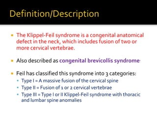 Klippel-Feil Syndrome | PPTX