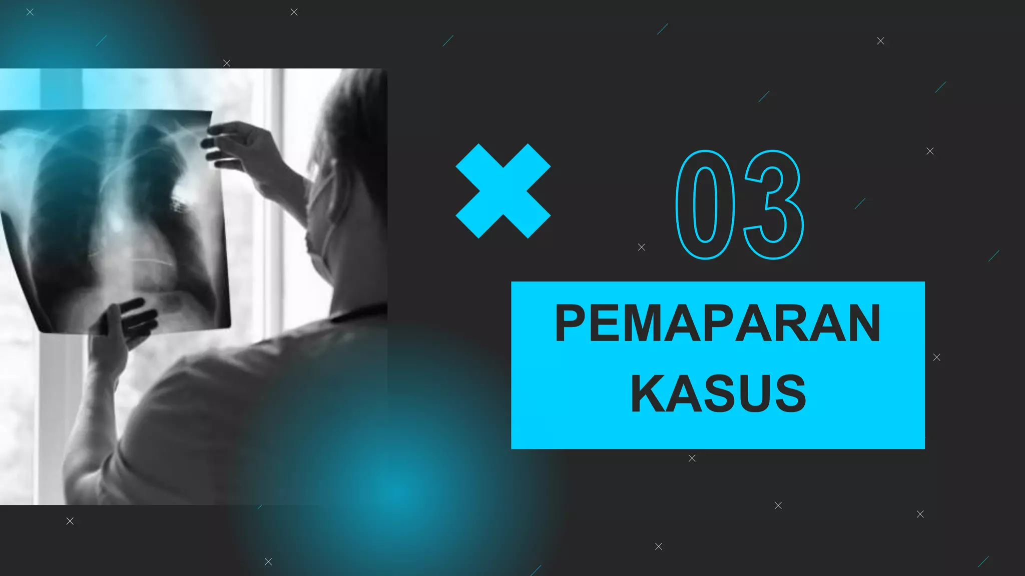 KLP 1 TR 3 COLON IN LOOP PEDIATRIC.pptx