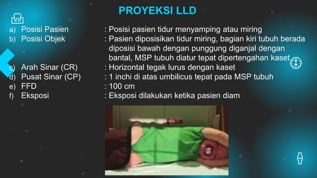 KLP 1 TR 3 COLON IN LOOP PEDIATRIC.pptx