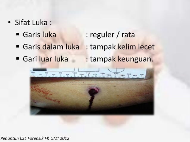 Luka Tembak Forensik | PPTX