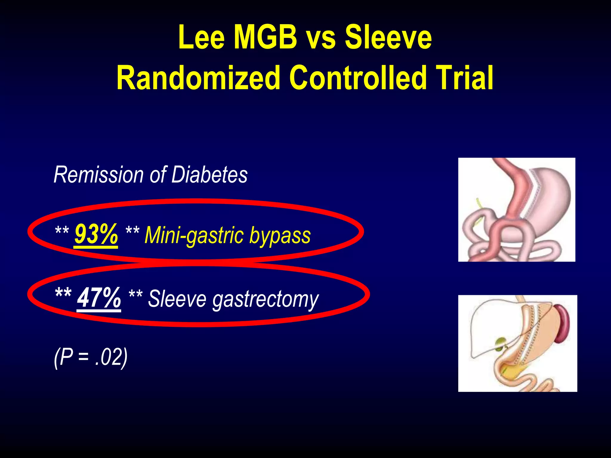 Kular Sleeve vs Mini-Gastric Bypass | PPTX