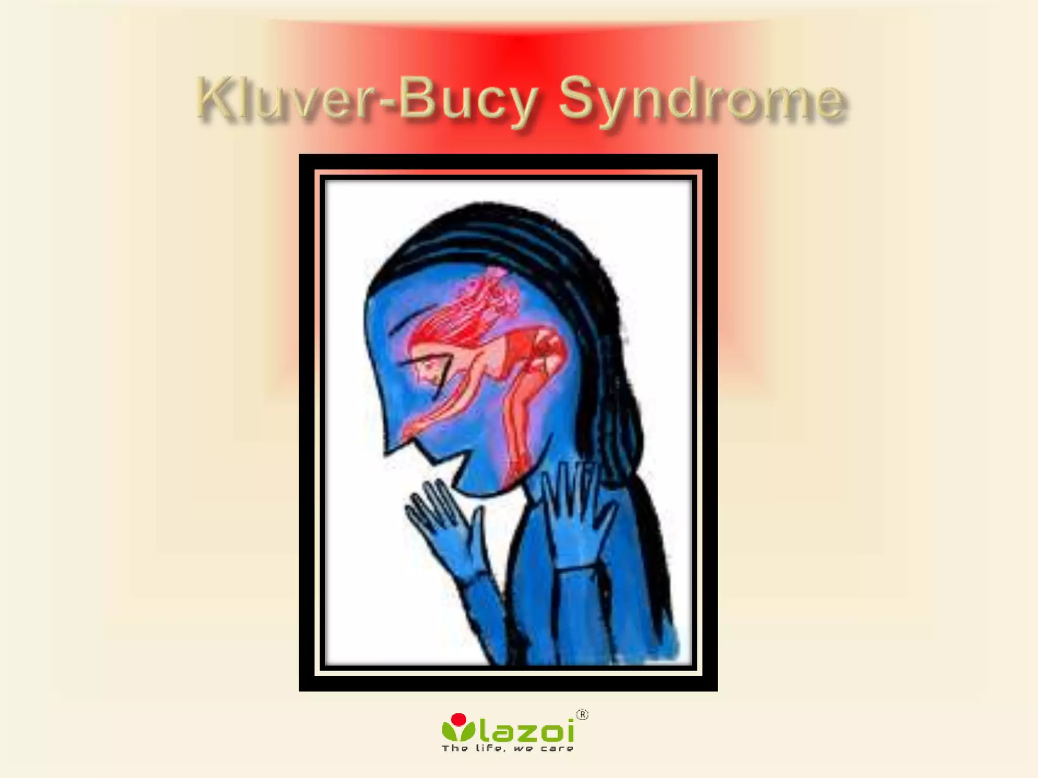 Kluver bucy syndrome | PPTX
