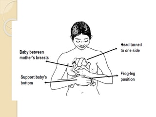 Kangaroo Mother Care . neonate. newborncare | PDF