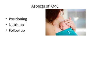 Kangarooo mother care pptKangarooo mother care ppt | PPT