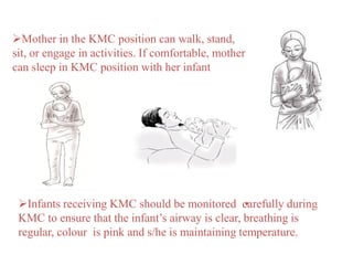 KMC-PPT for any preterm babies and proper care | PPT