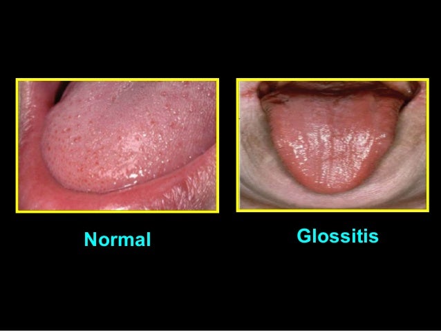 Water soluble vitamins